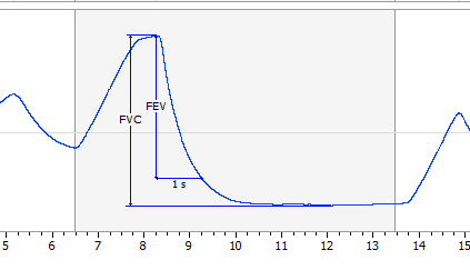 Spirometry | Respiratory and lung function testing | ADInstruments